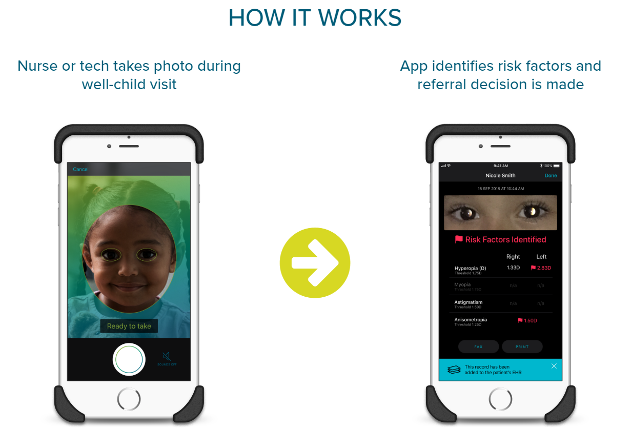 Machine Learning Infrastructure for Vision Screening